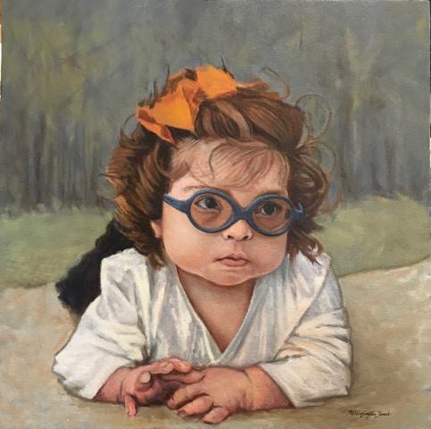 Beautiful Portrait of Child with Bohring-Opitz Syndrome Featured in ...